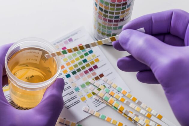 The Legal Obligations UK Businesses Have Around Workplace Drug Testing ...